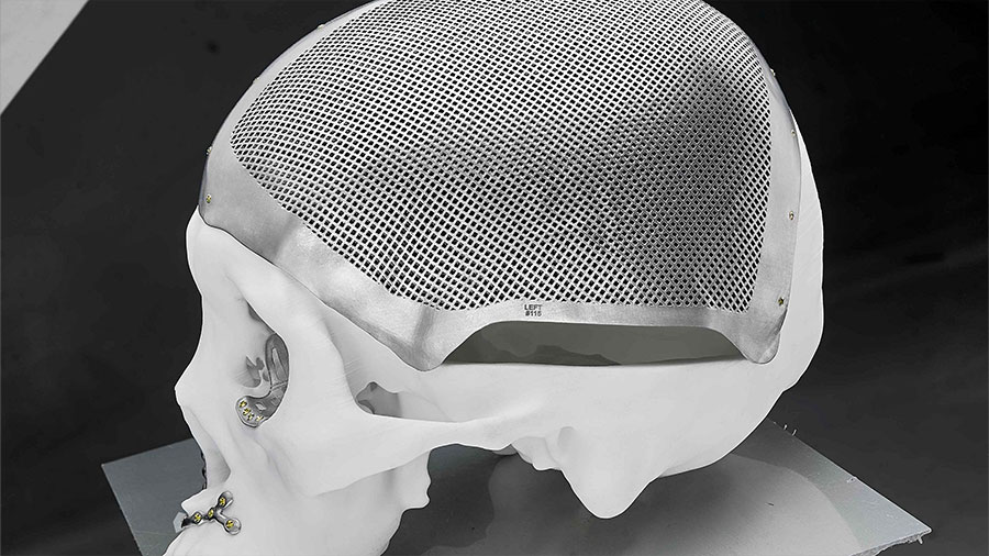 Personalizzazione delle protesi dentali con la stampa 3D - Targatocn.it