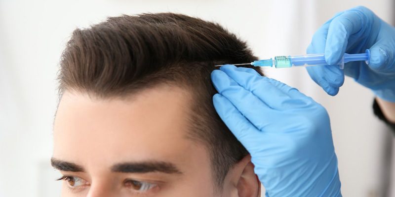Trapianto di capelli in Turchia e cellule staminali - Targatocn.it